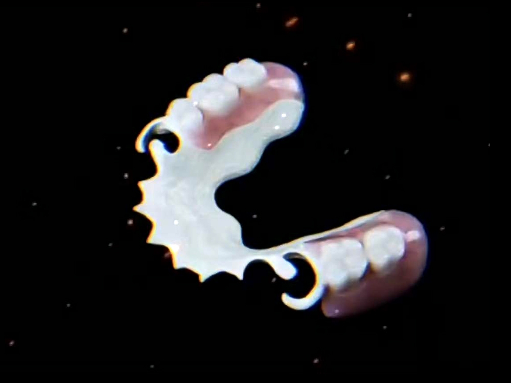 14 - Buy Implant All, Digital Case, Denture Attachment Product on New ...