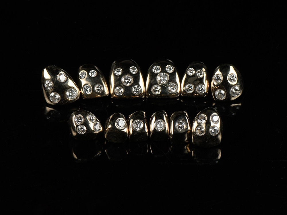 13 - Buy Implant All, Digital Case, Denture Attachment Product on New ...